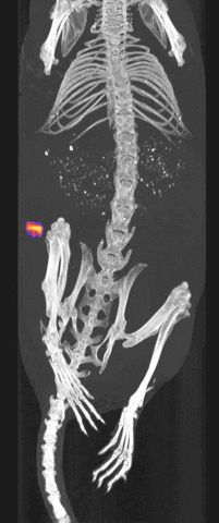 3D Cancer GIF by TriFoil Imaging - Find & Share on GIPHY