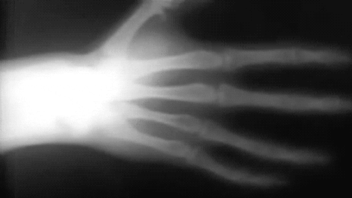 X-Ray Anatomy GIF - Find & Share on GIPHY