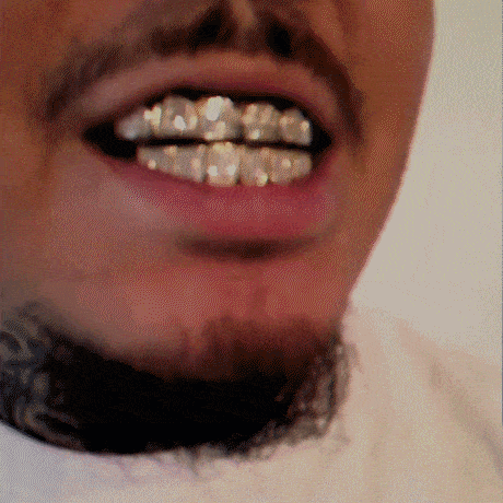 Teeth GIF - Find & Share on GIPHY