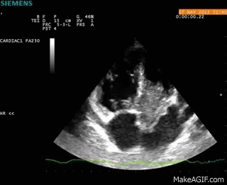 Echo GIF - Find & Share on GIPHY