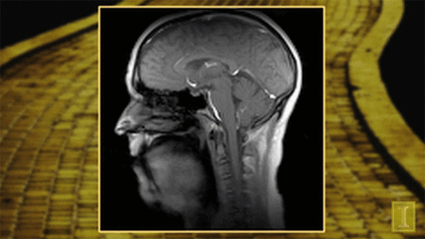 Mri GIF - Find & Share on GIPHY