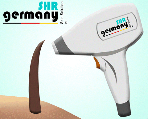 Hair Laser GIF by SHR Germany - Find & Share on GIPHY