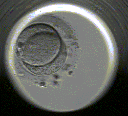 Die ICSI in GIFs: Der erste Ultraschall | Die Sache mit den Wundern