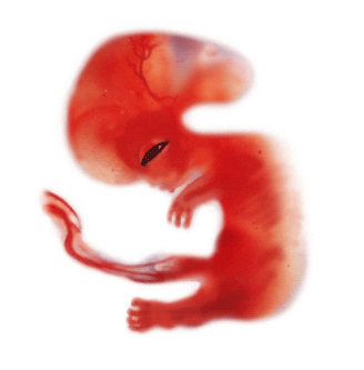 Baby Fetus Sticker by claudiamate for iOS & Android | GIPHY