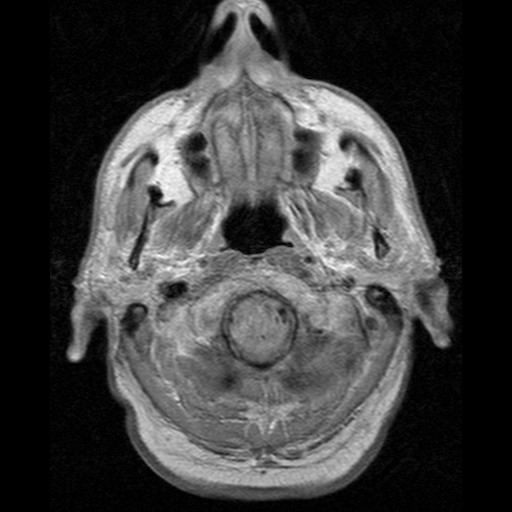 Mri GIF - Find & Share on GIPHY