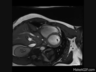 Mri GIF - Find & Share on GIPHY