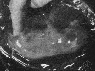 Nervous System GIFs - Get the best GIF on GIPHY