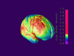 Brain GIF - Find & Share on GIPHY