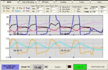 Biomedical Engineering GIFs - Get the best GIF on GIPHY