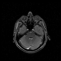 Brain Mri GIFs - Find & Share on GIPHY