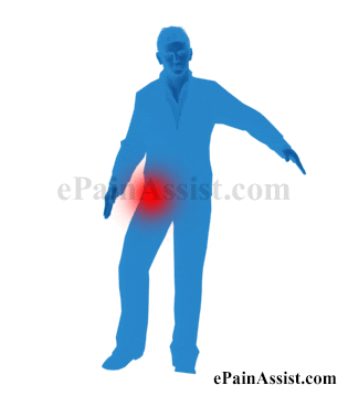 Unusual Movements Hip Tendonitis GIF by ePainAssist - Find & Share on GIPHY