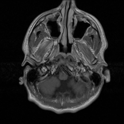 Mri GIF - Find & Share on GIPHY