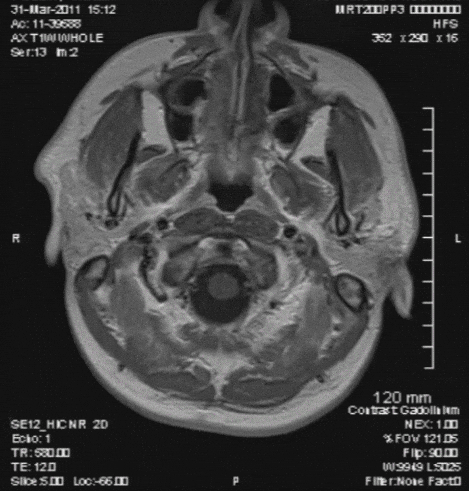 Head Mri GIF - Find & Share on GIPHY