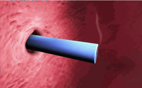Biomedical-Engineering GIFs - Find & Share on GIPHY