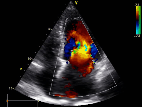 Echo GIFs - Find & Share on GIPHY