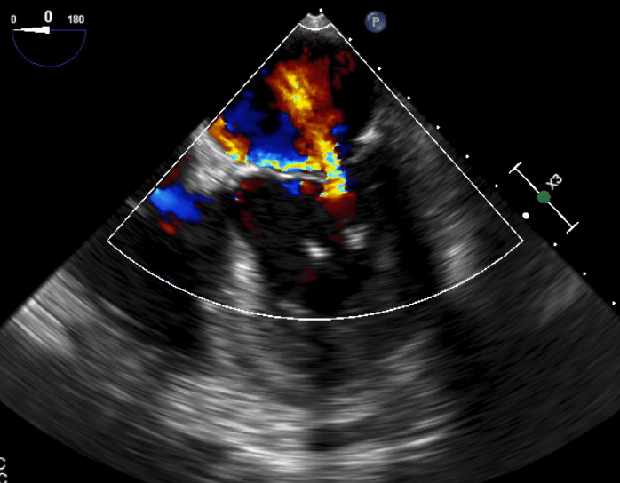 Echo GIF - Find & Share on GIPHY