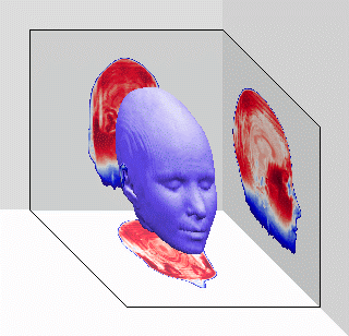 Mri GIF - Find & Share on GIPHY