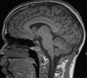 Mri GIF - Find & Share on GIPHY