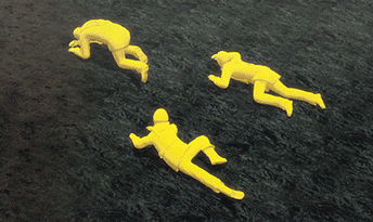 Jaundice GIFs - Find & Share on GIPHY