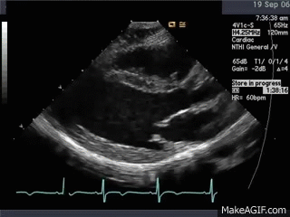 Echo GIF - Find & Share on GIPHY