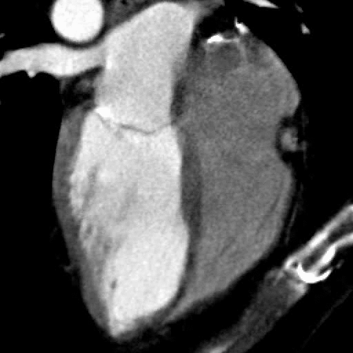 The Normal Heart GIF - Find & Share on GIPHY