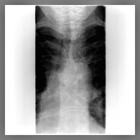 Xray GIFs - Find & Share on GIPHY