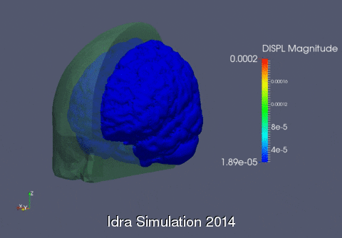 Brain GIF - Find & Share on GIPHY