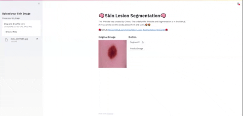 GitHub - crinex/SkiNet-Streamlit: My First Skin Lesion Segmentation App