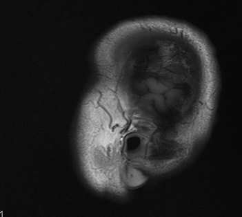 Mri GIF - Find & Share on GIPHY