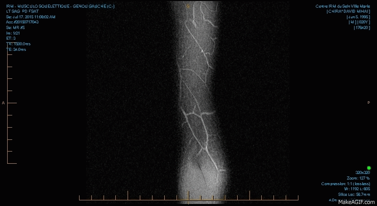 Mri GIF - Find & Share on GIPHY