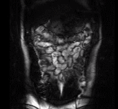 Mri GIF - Find & Share on GIPHY