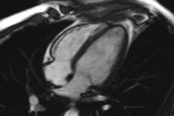 Mri GIF - Find & Share on GIPHY