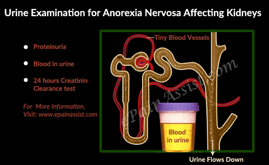 Urine Examination For Anorexia Nervosa Affecting Kidneys GIF by ...
