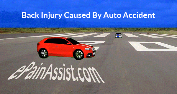 Back Injury Caused By Auto Accident GIF - Find & Share on GIPHY