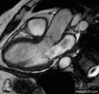 Mri GIF - Find & Share on GIPHY