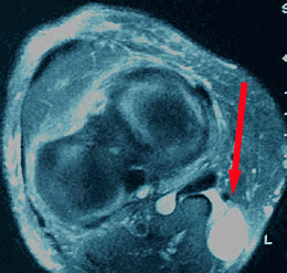 Mri GIF - Find & Share on GIPHY